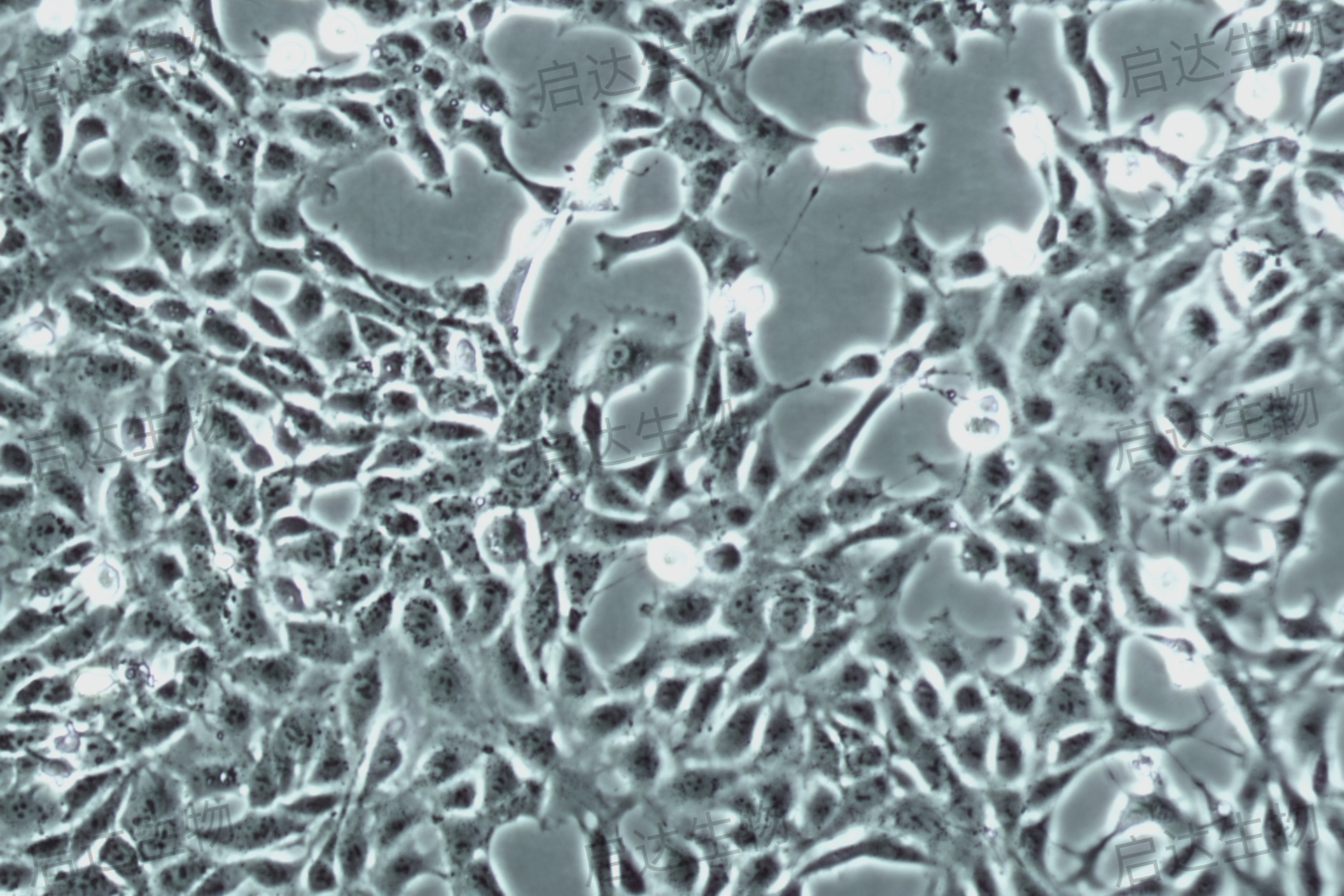 MPC-5细胞, MPC5细胞, 小鼠肾足细胞-上海启达生物科技有限公司